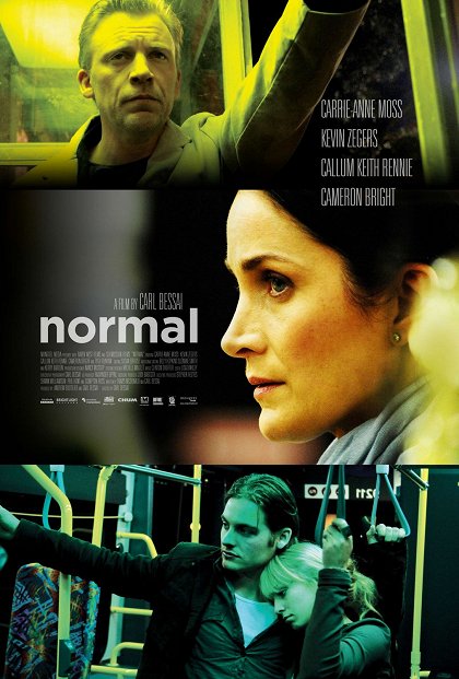 Normal (2007) | ČSFD.cz