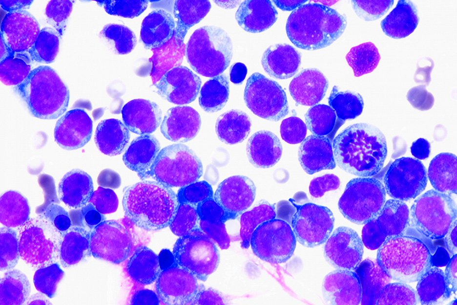 Cancer: The Emperor of All Maladies (2015) | ČSFD.sk