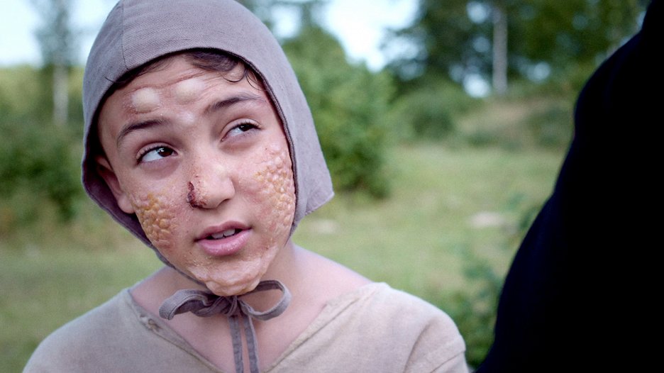 Världens hemskaste sjukdomar (2019) | ČSFD.cz